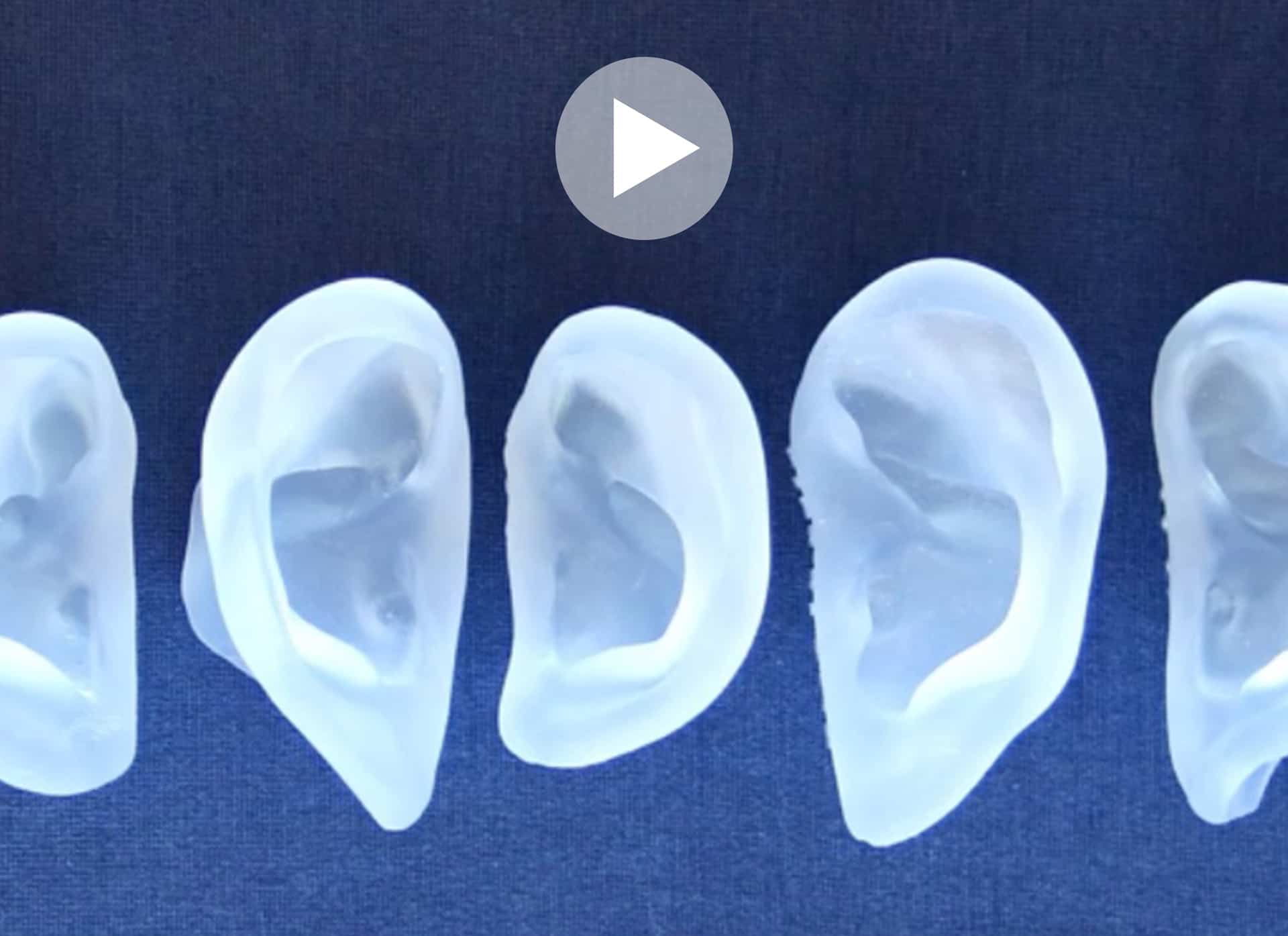 3D Lewin Ear - Lewin Ear Reconstruction